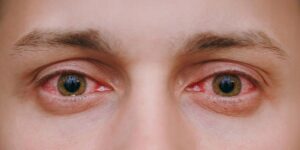 Side Effects of Cocaine Abuse | NATC