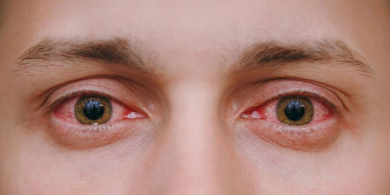 Side Effects of Cocaine Abuse | NATC